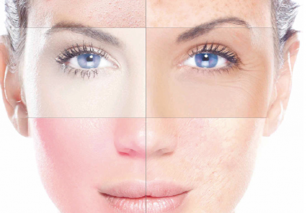 How to identify and take care of various skin types? My methods